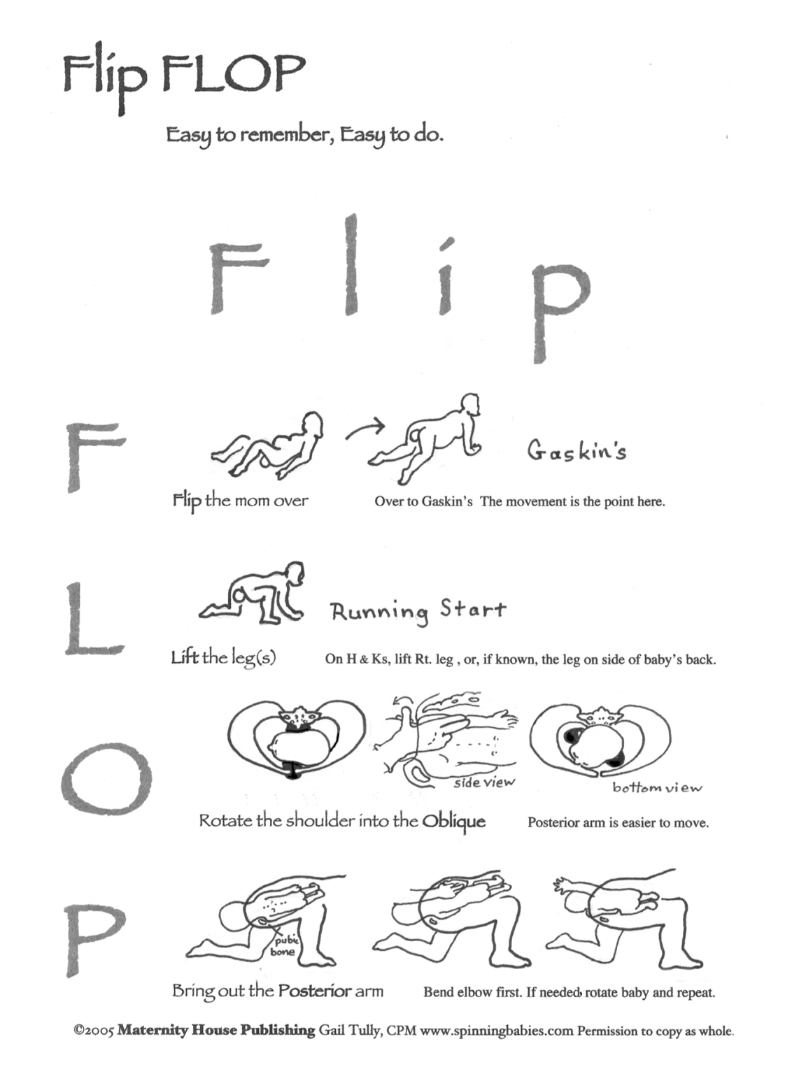 Midwifery Today Resolving Shoulder Dystocia with the Gaskin Maneuver or ...
